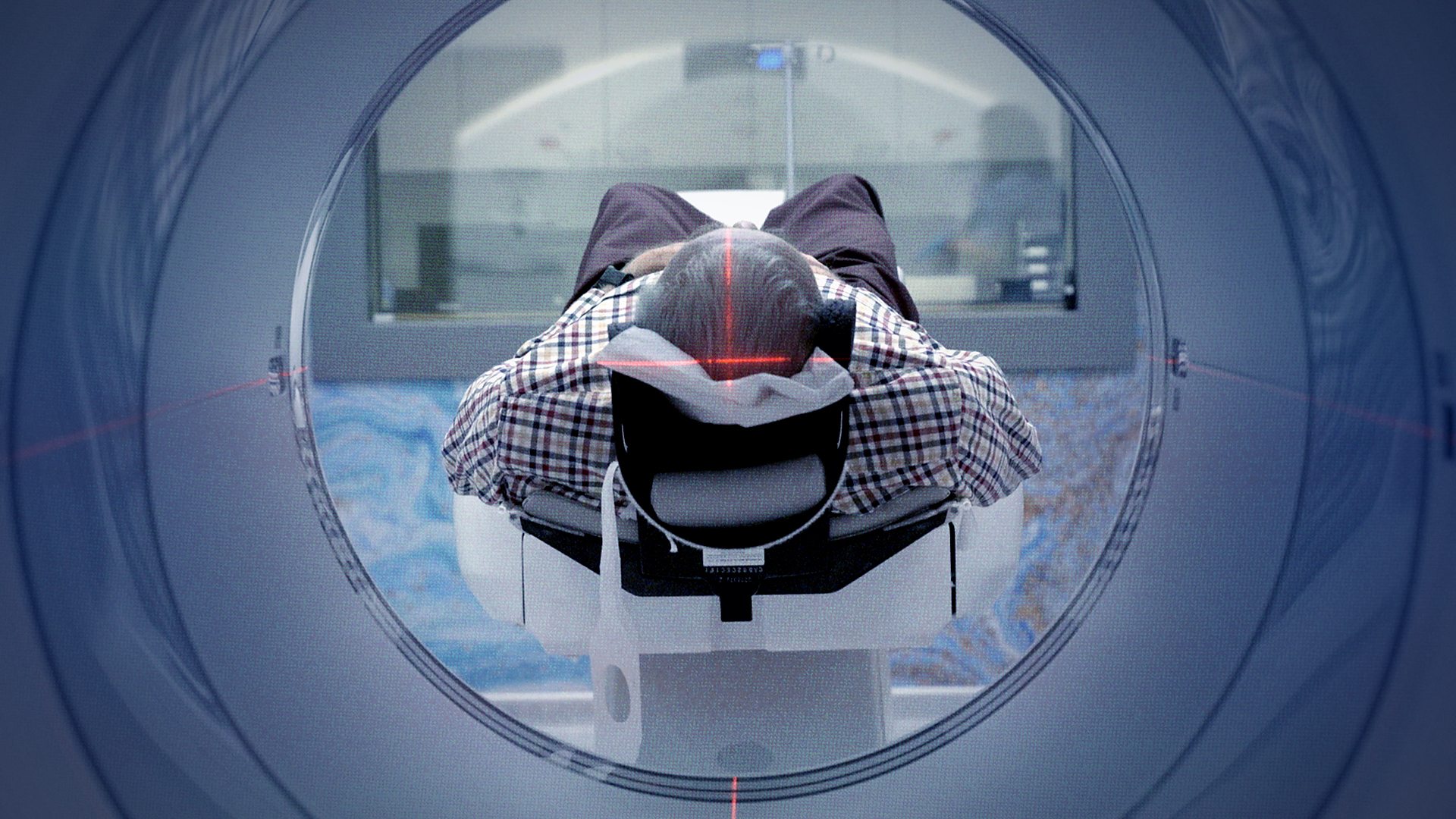 How to watch Alzheimer’s: A Turning Point? in the US on BBC iPlayer ...